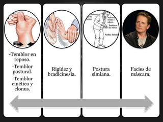 Enfermedad de Parkinson. | PPTX