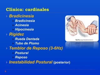 Enfermedad de Parkinson | PPTX