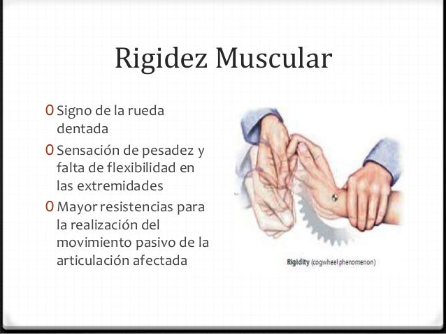 Enfermedad de parkinson