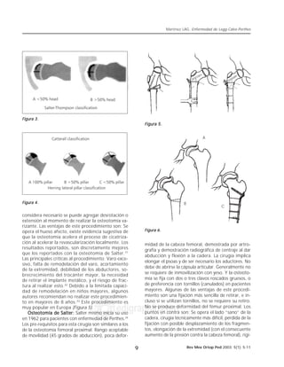 Enfermedad de Legg Calve Perthes | PDF