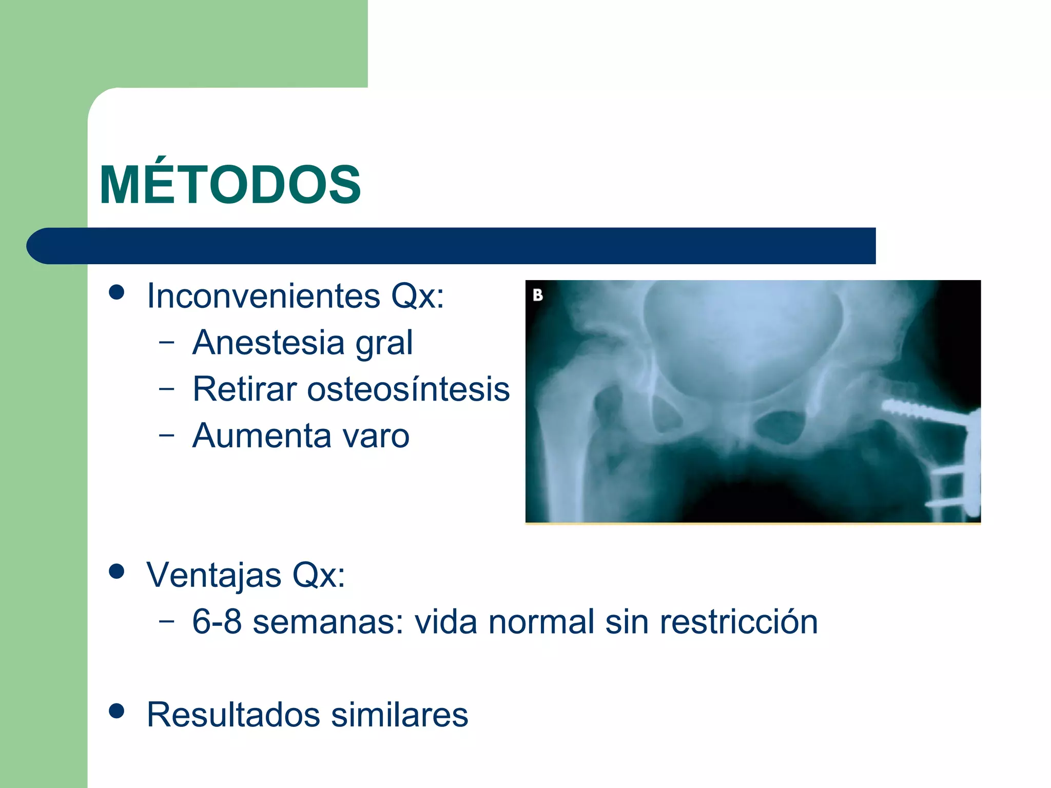 Enfermedad de perthes | PPT