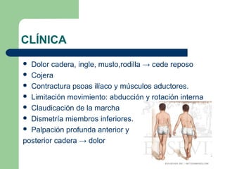 Enfermedad de perthes | PPT