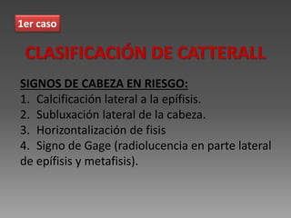 Enfermedad de perthes y epifisiolistesis femoral proximal (Casos ...