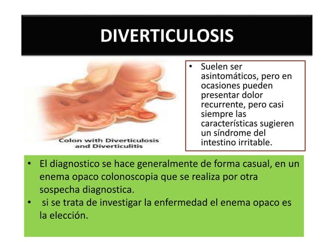Enfermedad Diverticular Ppt