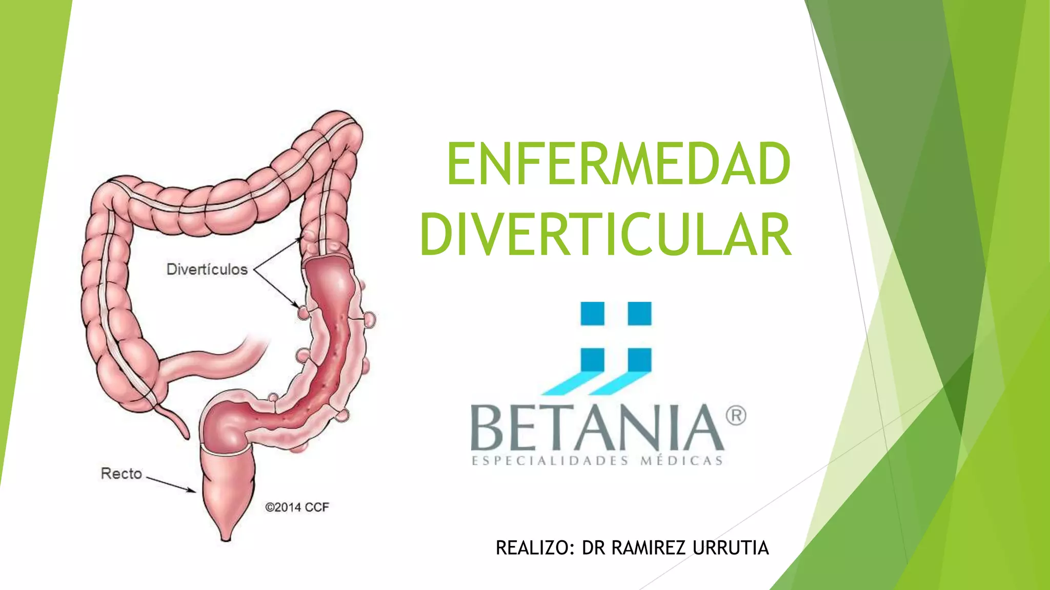 Enfermedad diverticular | PPT