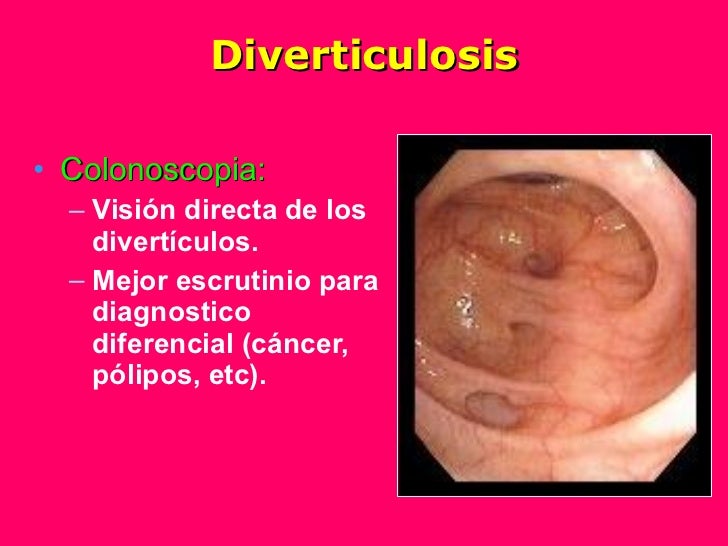 Enfermedad diverticular (1)