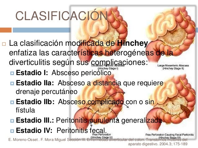 Enfermedad diverticular de colon