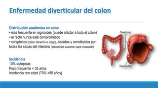 Enfermedad Diverticular del colon Carlos Hernandez CARORA | PPTX