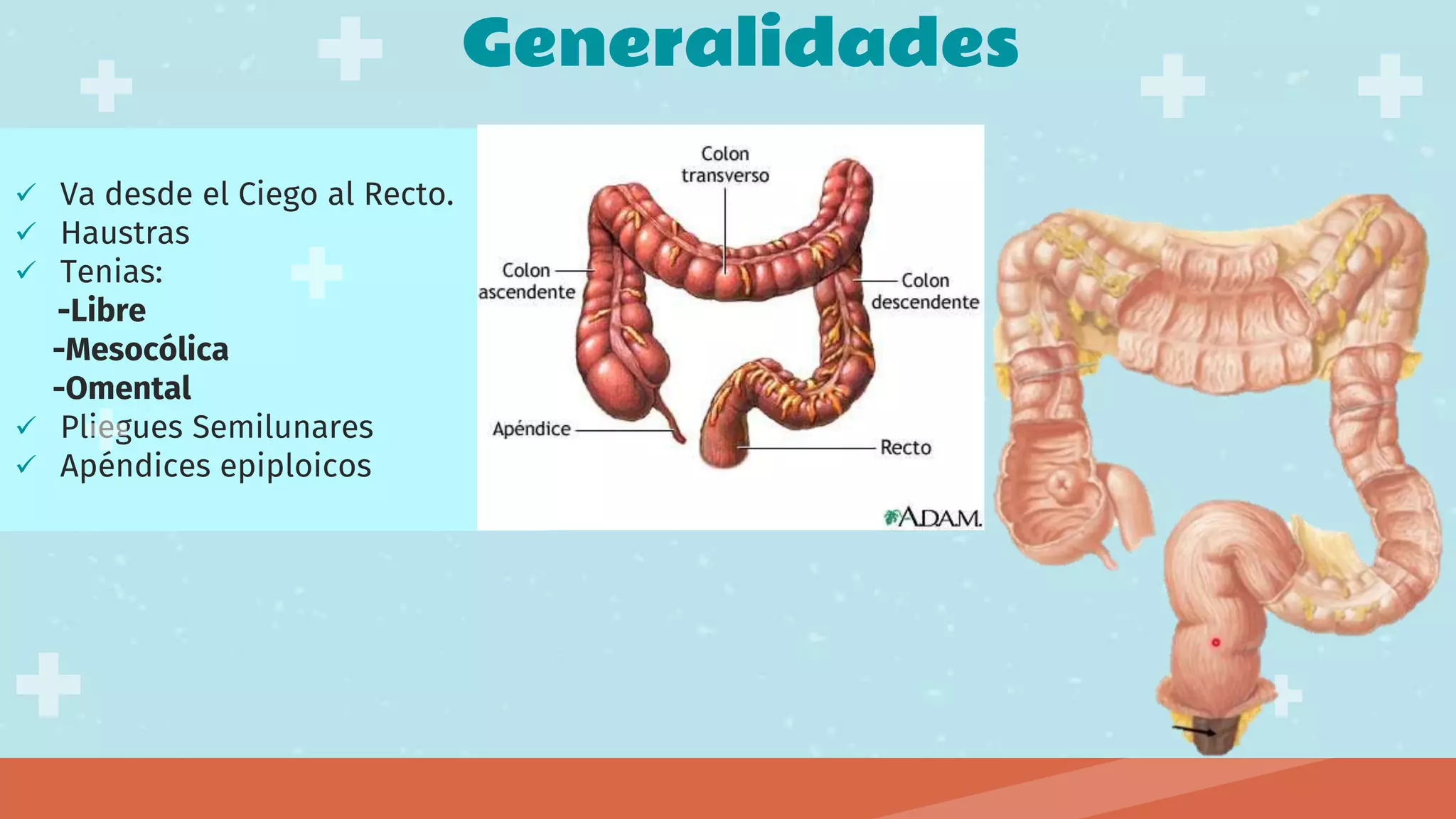 Enfermedad Diverticular del Colon.pptx