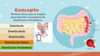 Enfermedad Diverticular del Colon.pptx