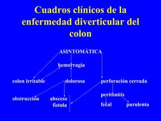 Enfermedad Diverticular Del Colon | PPT