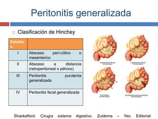 Enfermedad Diverticular | PPT