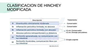 ENFERMEDAD DIVERTICULAR Y DIVERTICULITIS.pptx