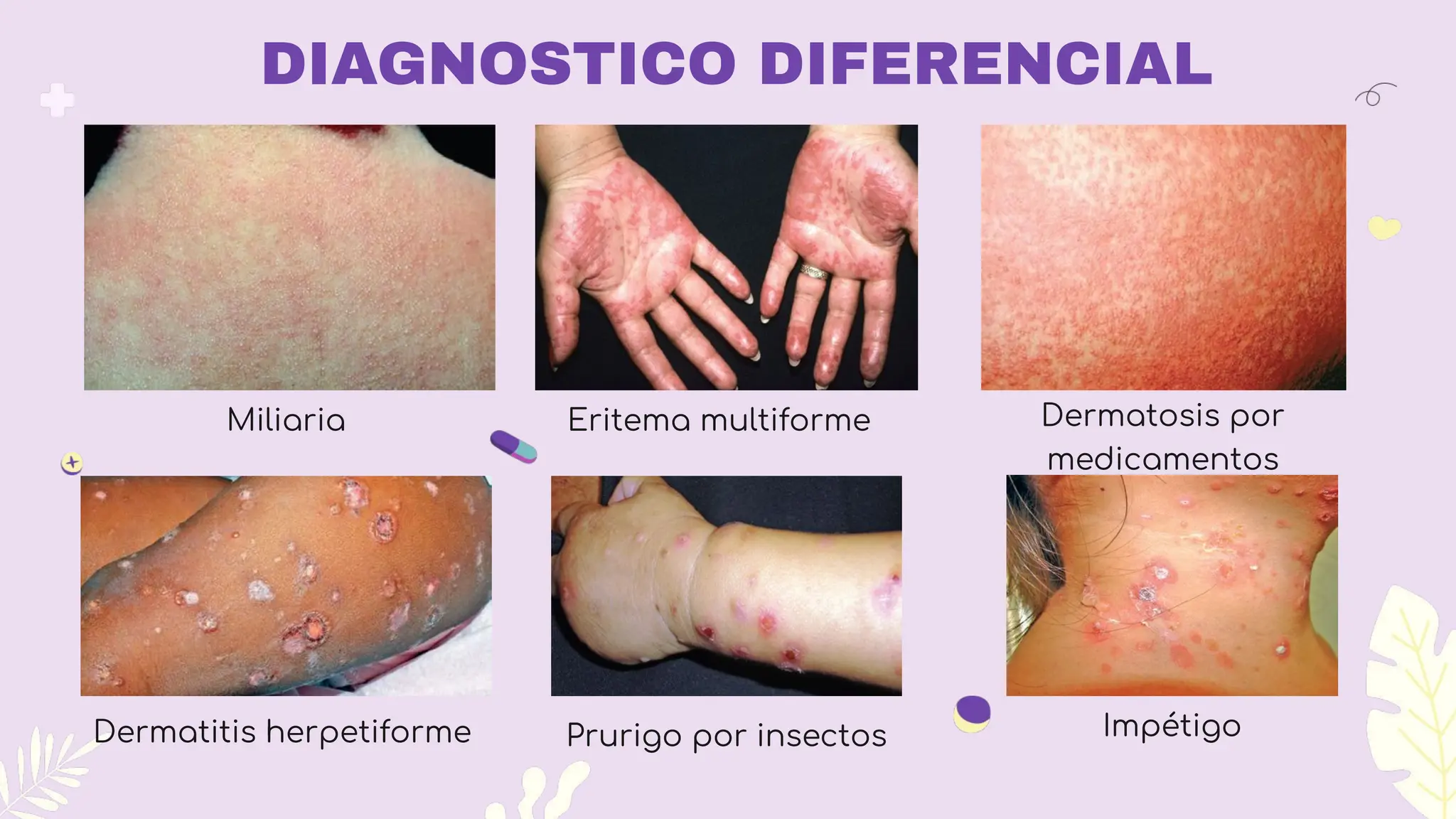 Enfermedade exantemáticas pediatría. pdf | PDF