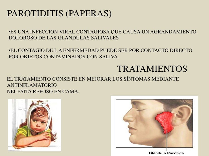 Parotiditis Que Es