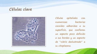 Enfermedades benignas-de-vulva-y-vagina | PDF
