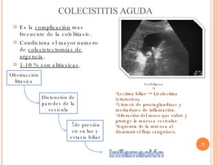 Enfermedades De La VesíCula Biliar Y De Las Vias Biliares | PPT
