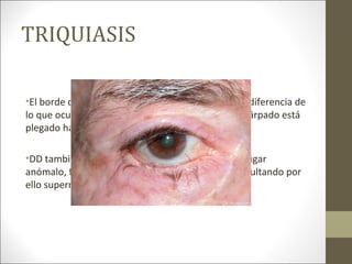 Enfermedades de-los-pc3a1rpados2 | PPT