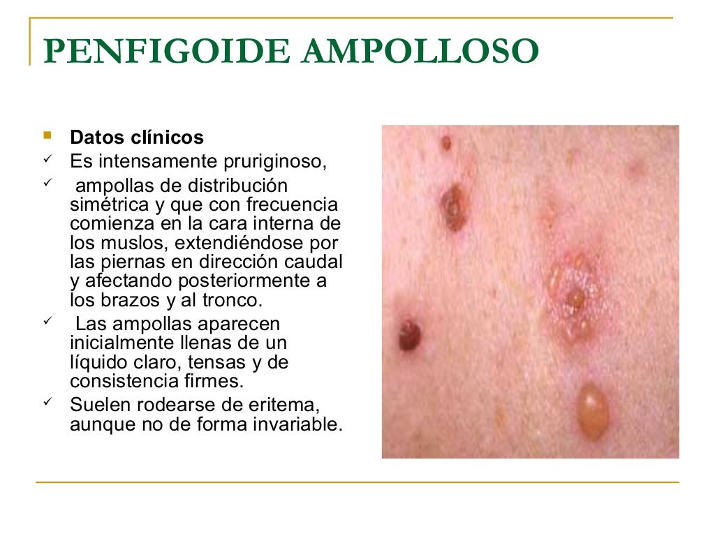 Enfermedades Ampollosas de la Piel | UASD