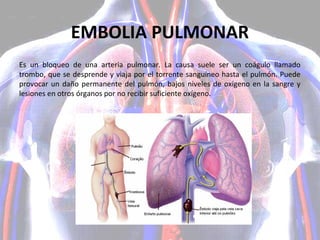 Enfermedades aparato circulatorio y excretor | PPT