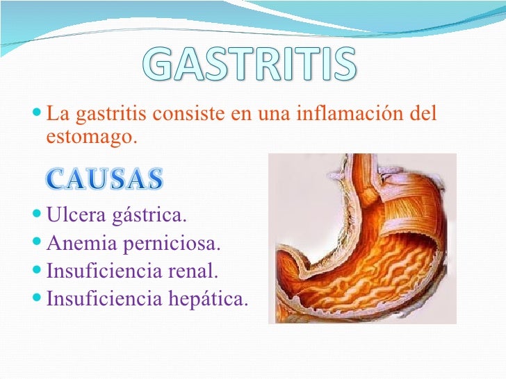 Las 15 Enfermedades Del Aparato Digestivo Ms Comunes Avances En Las