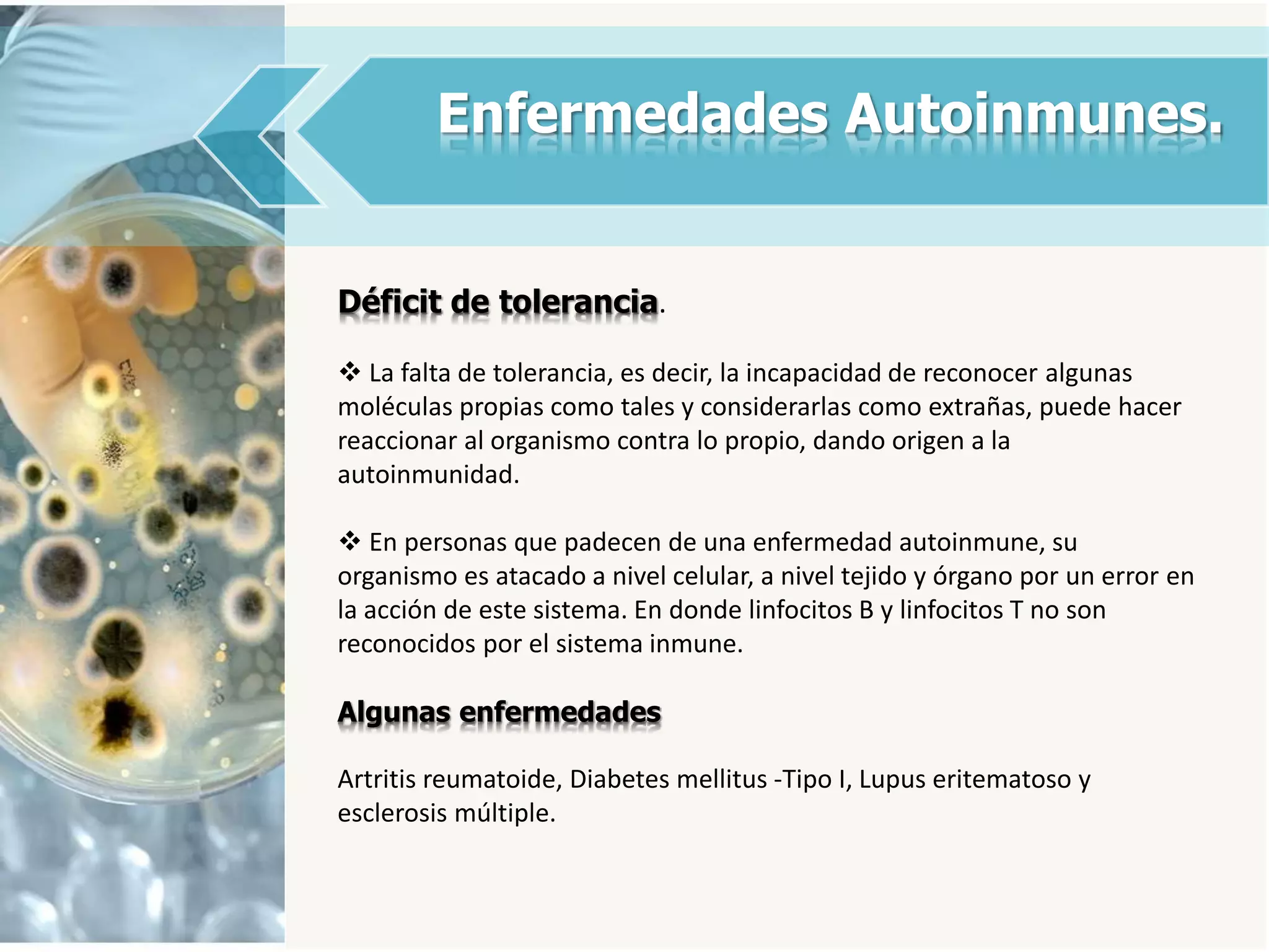 Enfermedades autoinmunes | PPTX