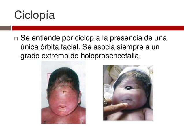 ENFERMEDADES CONGÉNITAS