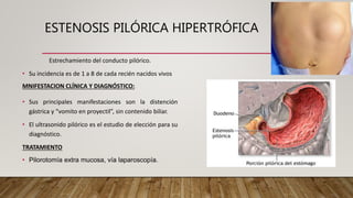 Enfermedades Congénitas del aparato digestivo.pptx