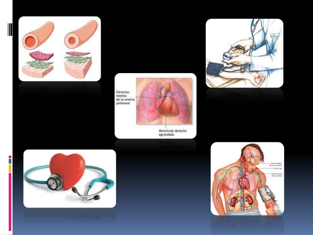 Enfermedades cronicas salud