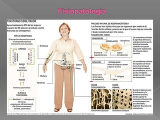 ENFERMEDADES CRONICO DEGENERATIVAS ELABORADO POR : SANDRA GODINEZ PÉREZ ...