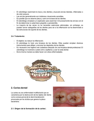 Enfermedades de la boca | DOCX