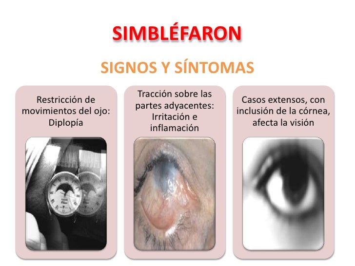 Enfermedades de la conjuntiva