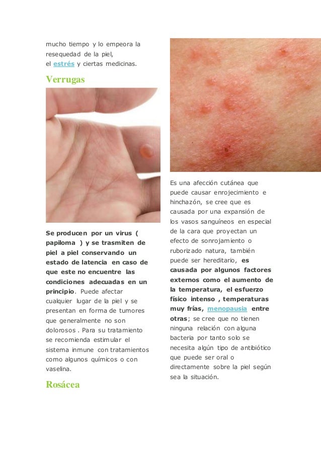 Estas Son Las Principales Enfermedades De La Piel Chapintv