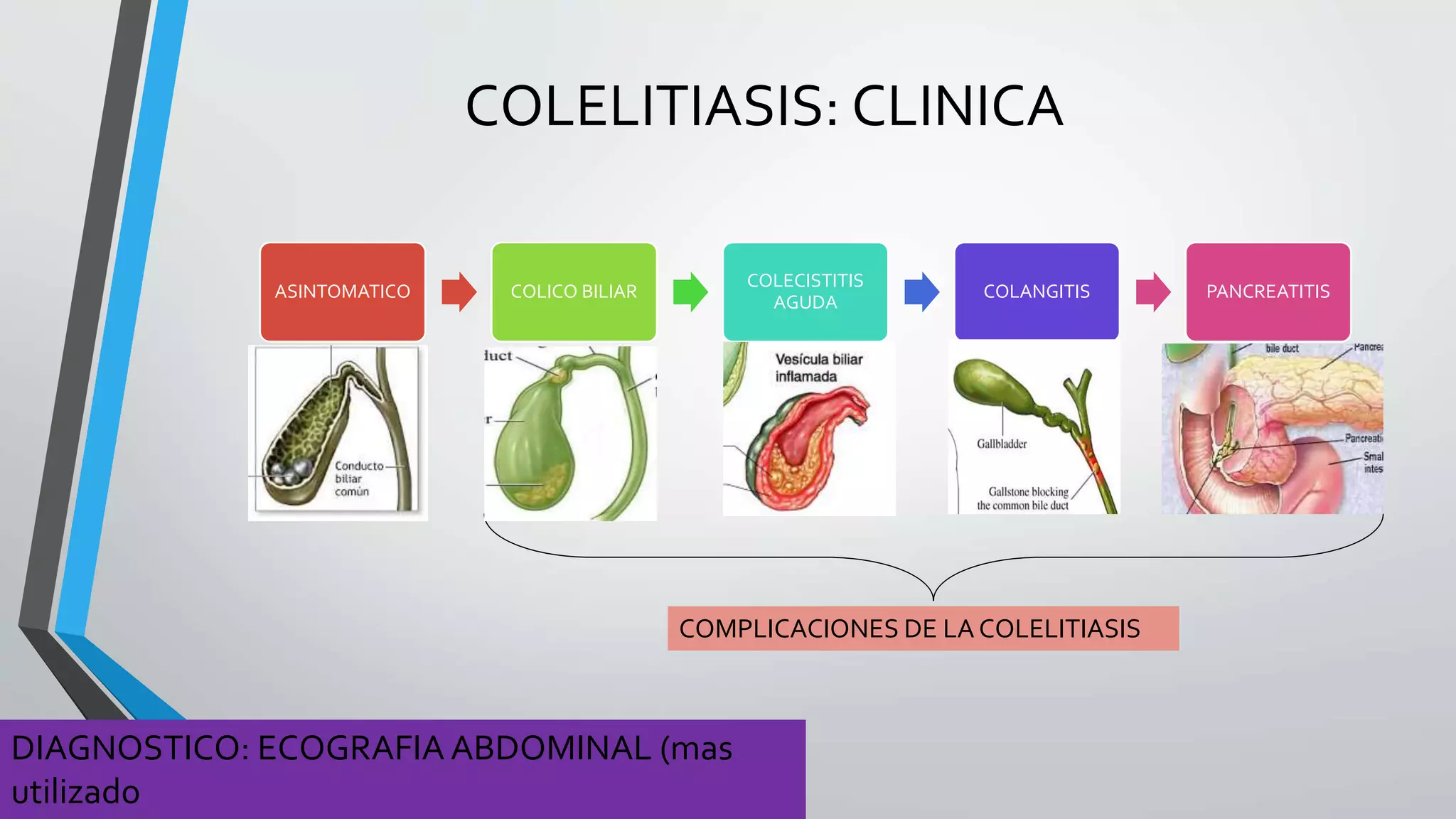 Enfermedades de la vesicula biliar y conductos biliares cto digestivo | PPT