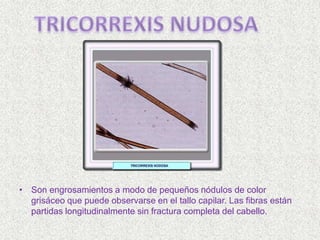 Enfermedades del cuero cabelludo y fibra capilar | PPTX