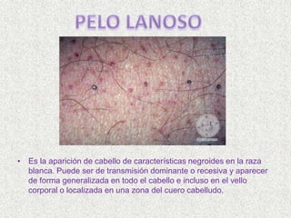 Enfermedades del cuero cabelludo y fibra capilar | PPTX