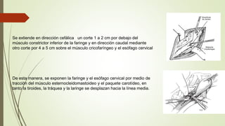 Enfermedades del esófago | PPTX