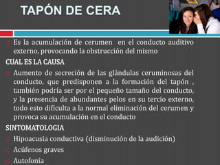 Enfermedades del oído | PPTX