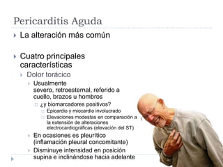 Enfermedades del pericardio | PPTX