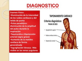 Enfermedades del pericardio | PPTX