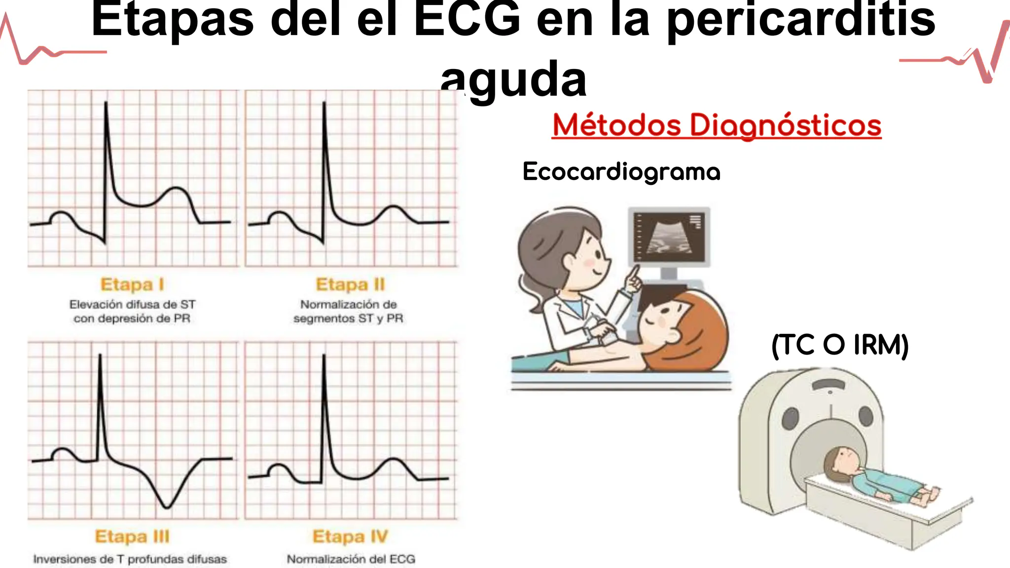 ENFERMEDADES DEL PERICARDIO Fácil se aprender.pptx