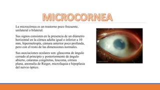 ENFERMEDADES DEL SEGMENTO ANTERIOR DURANTE EL PROCESO EMBRIONARIO.pptx