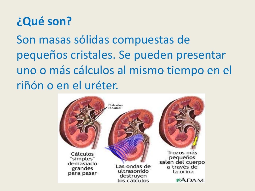 Enfermedades Del Sistema Excretor