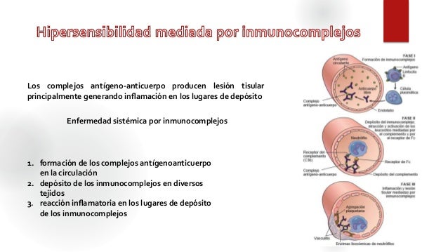 Enfermedades del sistema inmunitario