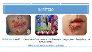 Principales Enfermedades Dermatologicas en Pediatria | PPTX
