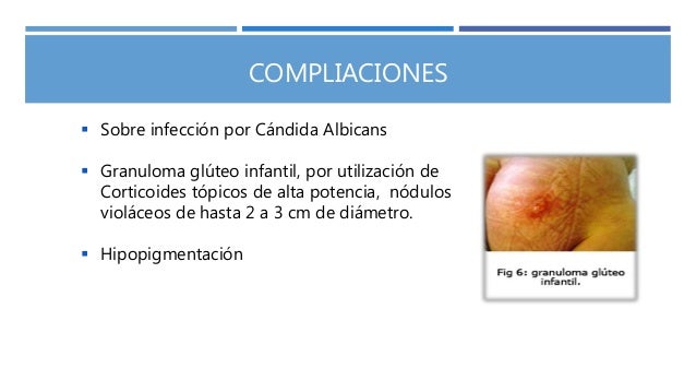 Principales Enfermedades Dermatologicas En Pediatria