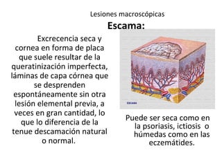 Enfermedades dermatologicas | PPT