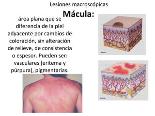 Enfermedades dermatologicas | PPT