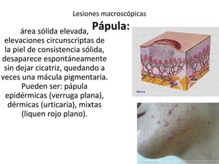 Enfermedades dermatologicas | PPT