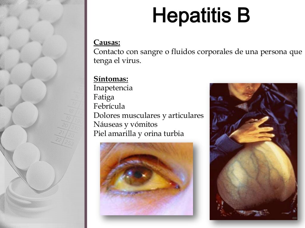 Clamidia, Hepatitis B y C [Enfermedades de transmisión sexual]
